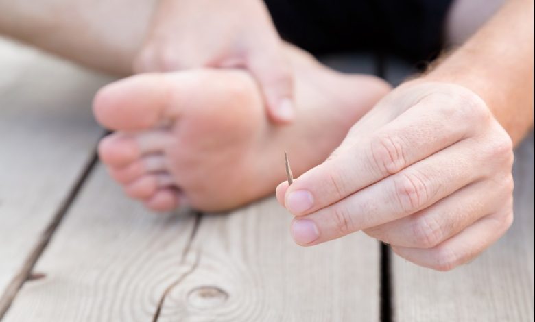 How to Deal with a Foreign Object Stuck in the Skin: A Step-by-Step ...